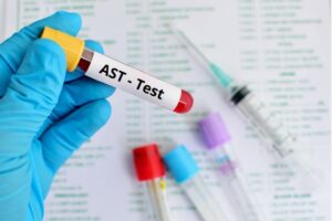 Aspartato Aminotransferasi (AST): Guida Completa e FAQ